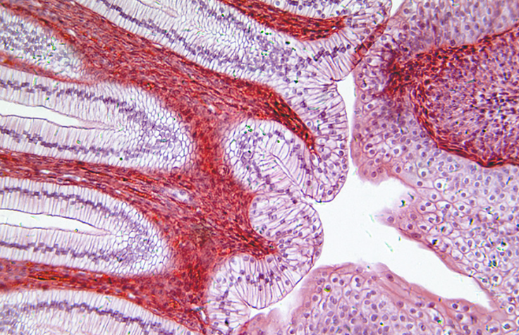 Overcoming high homology to detect variation in CYP21A2 with whole ...